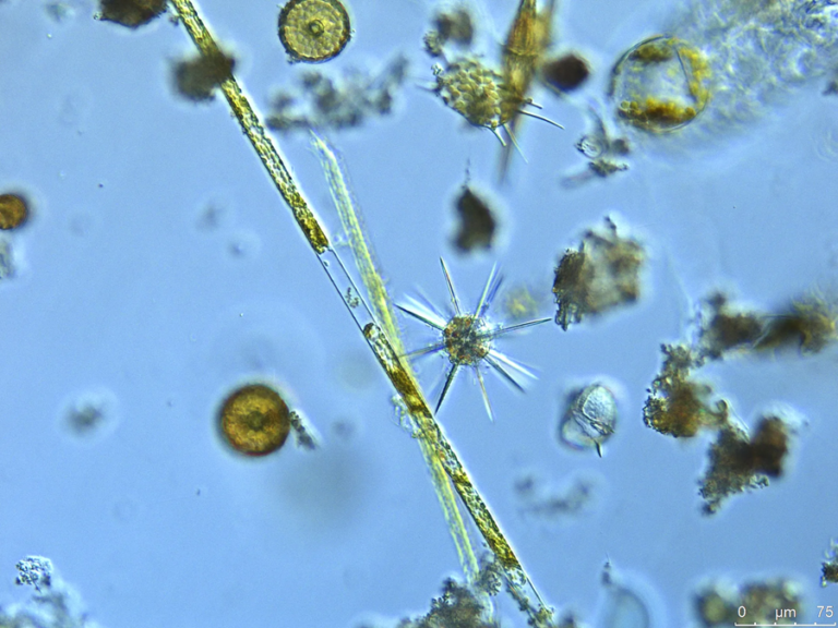 Plankton could hold key for understanding link between ocean pollution ...