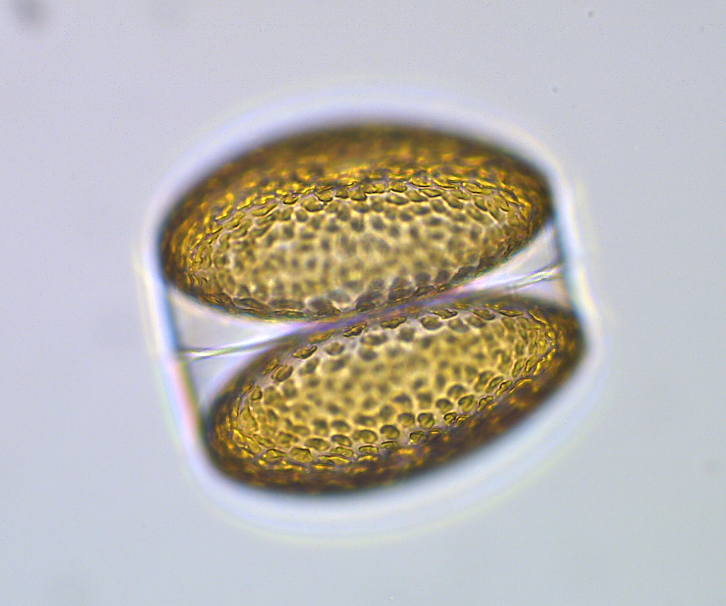 Diatoms reveal survival strategy under nutrient co-limitation | Marine ...